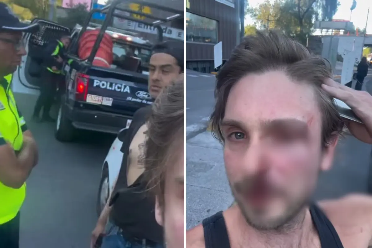 Actor Joan Kuri golpeado en Periférico por automovilista