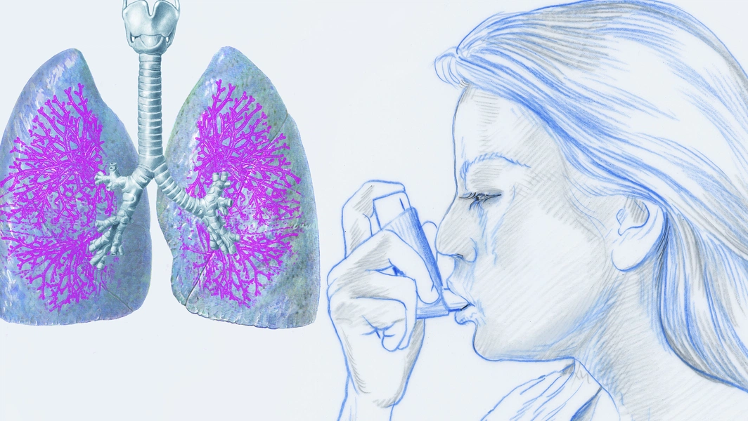 Asthma care tips that actually make a difference
