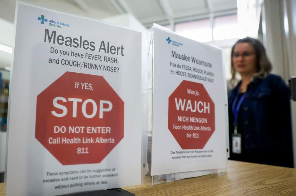 Calgary medical clinic site of potential measles exposure, province says