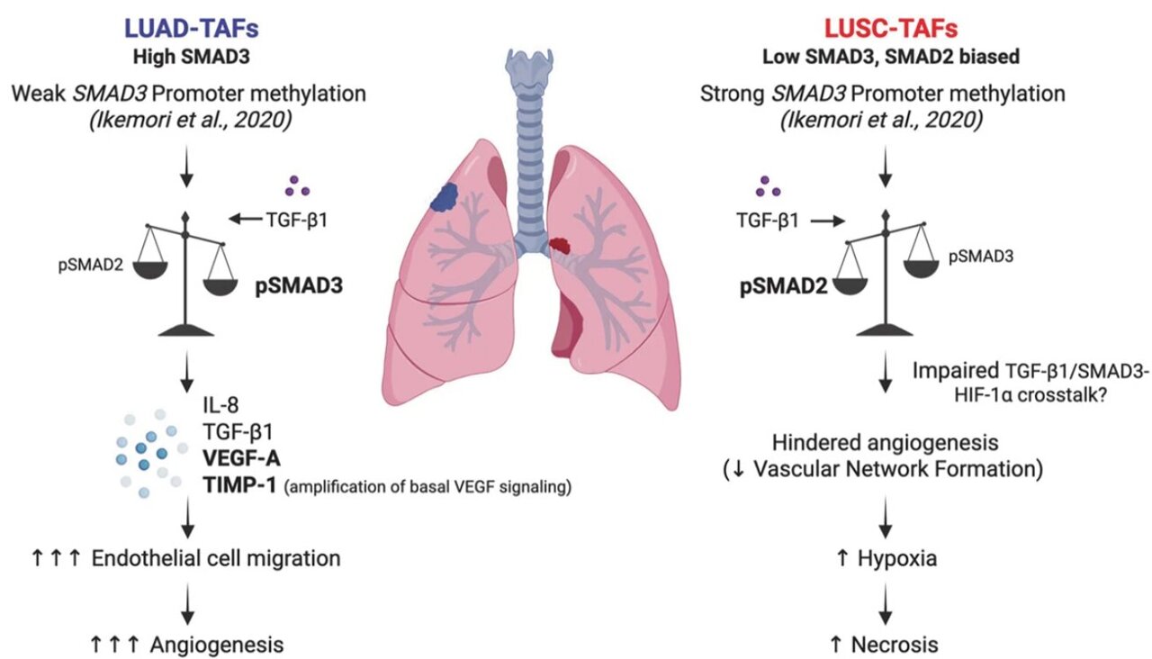 New breakthrough in developing more personalized treatments for lung cancer