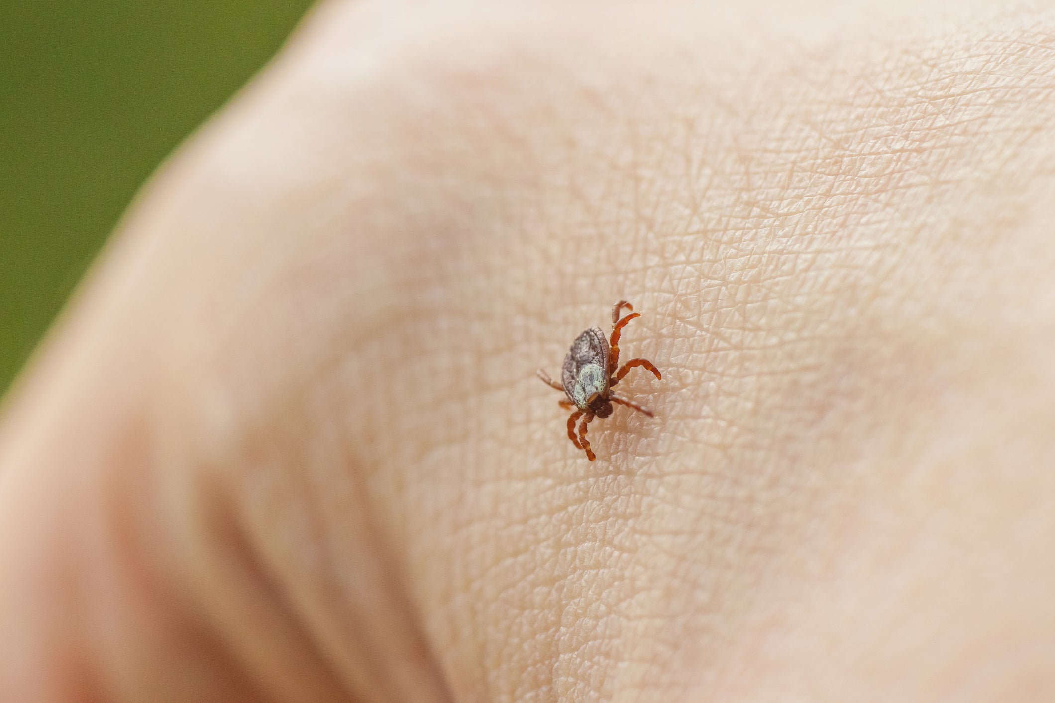Deadly tick-borne disease that can cause brain damage spreading across ...
