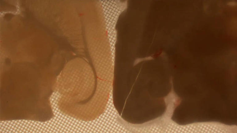 Scientists revive mouse brains frozen to -196°C, hinting at possible ...