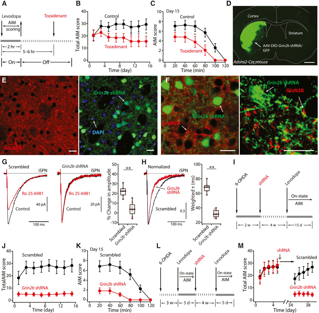 Potential gene therapy for late-stage Parkinson's side-effects uncovered