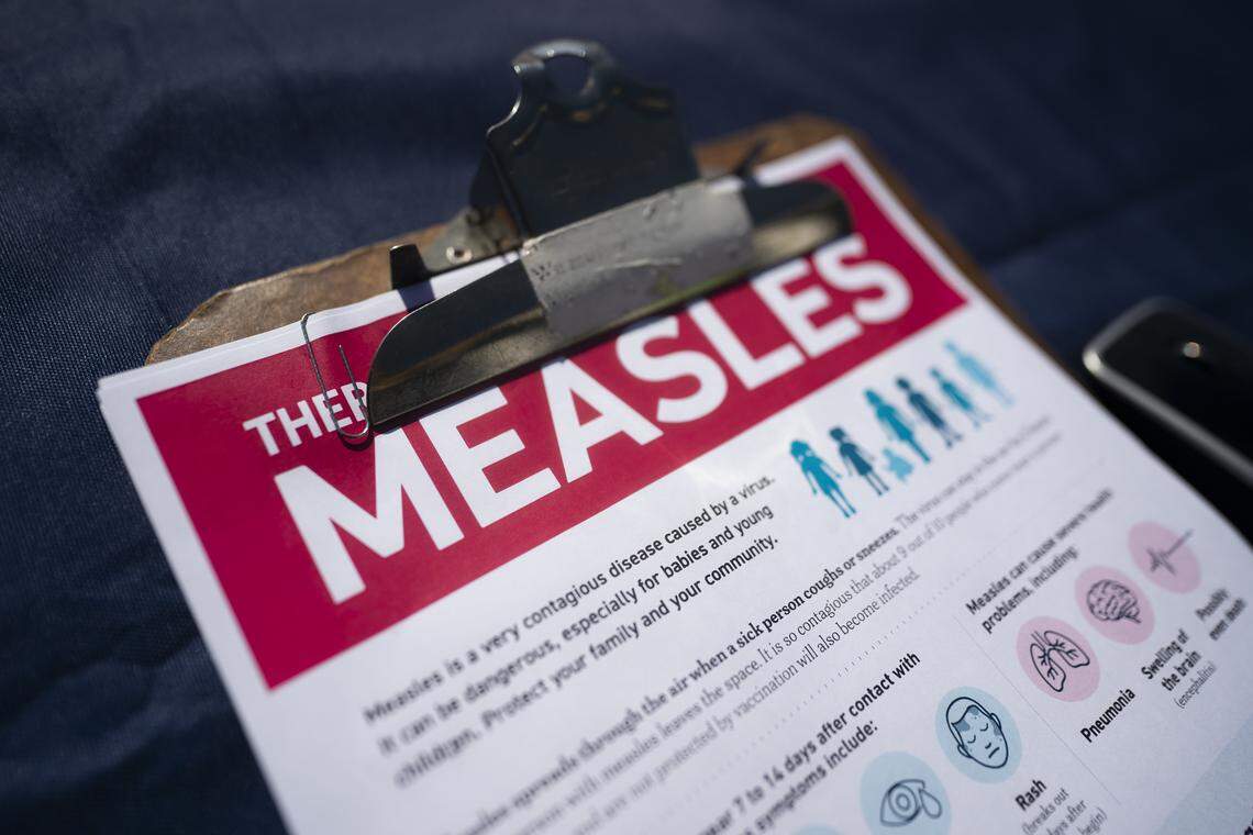 After SC measles outbreak declined, a new case is found in a new part ...