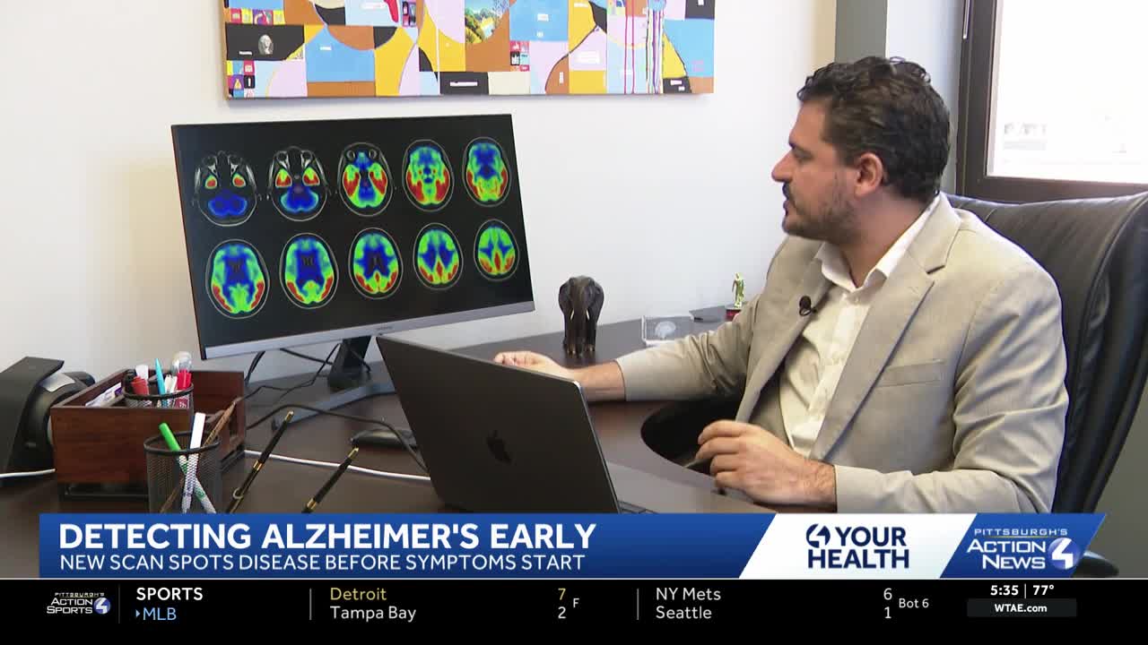 Detecting Alzheimer's early: UPMC, Pitt develop new imaging test that ...