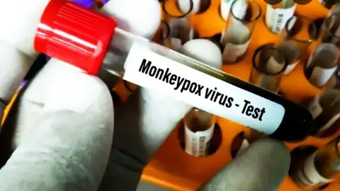 EE UU investiga la incautación de viales de viruela del mono en un ...