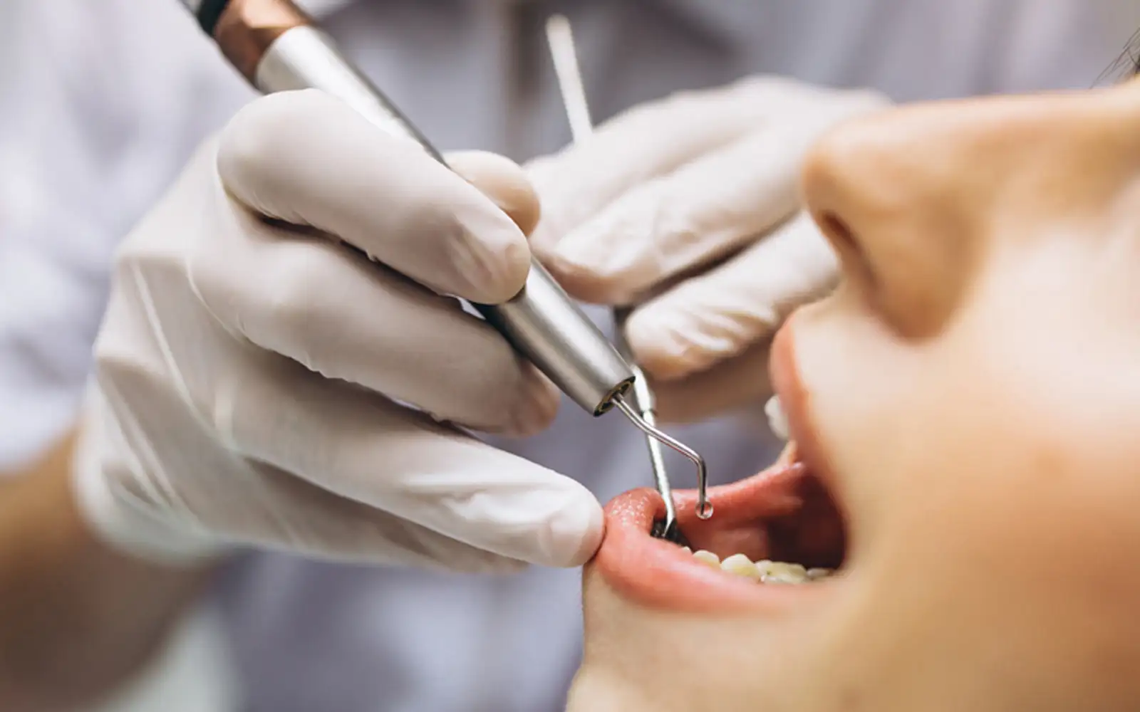 Could your gums have an effect on brain health?