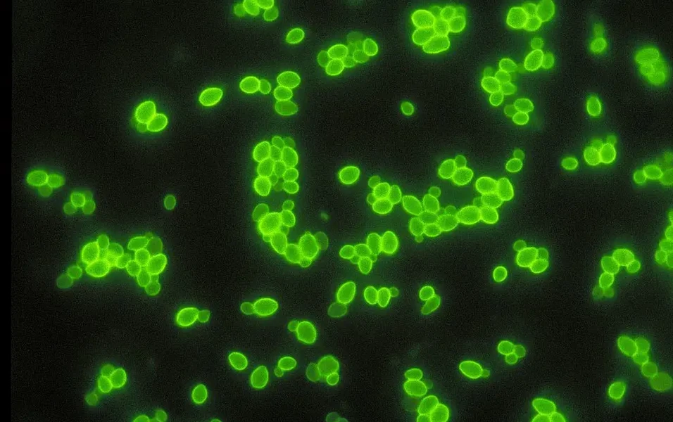 Candida overgrowth decoded for everyday health
