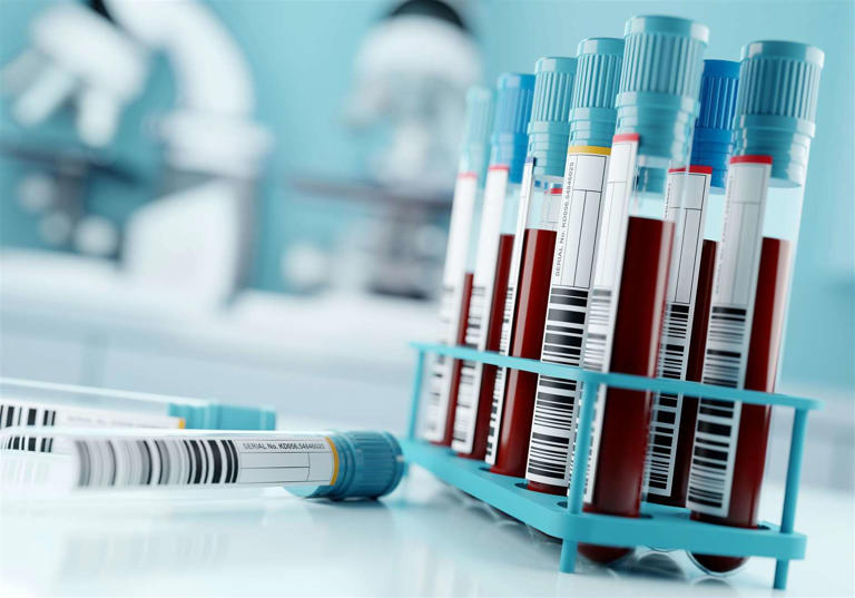 Dover woman suffered fatal allergic reaction after being given scan dye ...