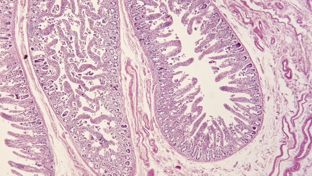 Small habits that make your gut thrive