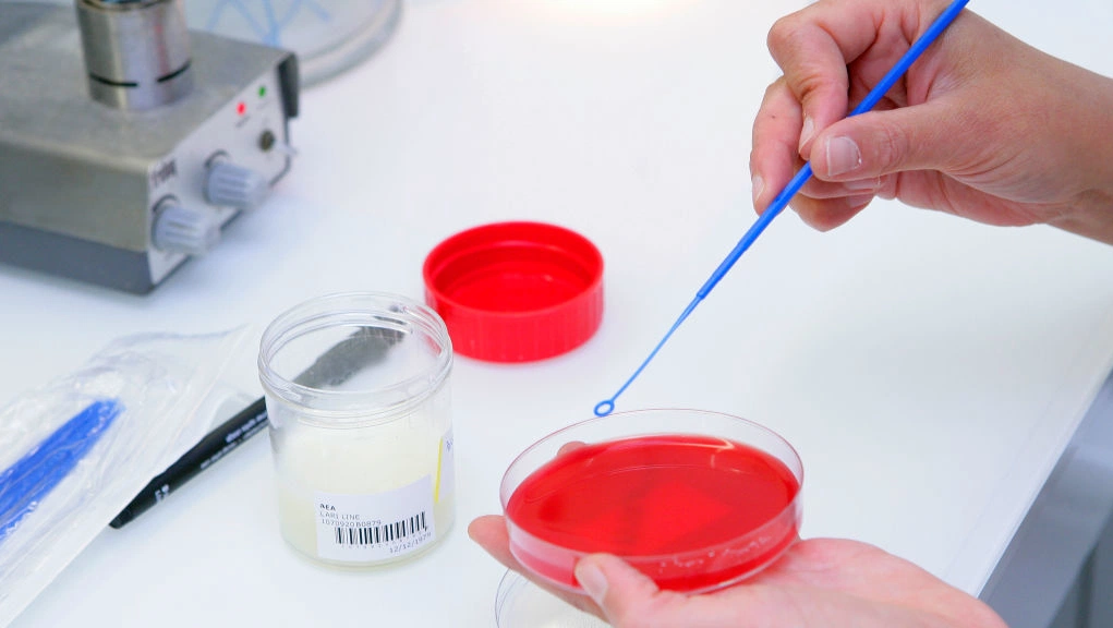 UTI prevention tips doctors swear by