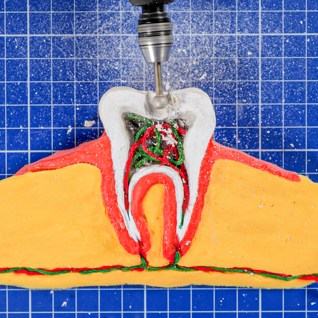 Teeth repairs explained simply