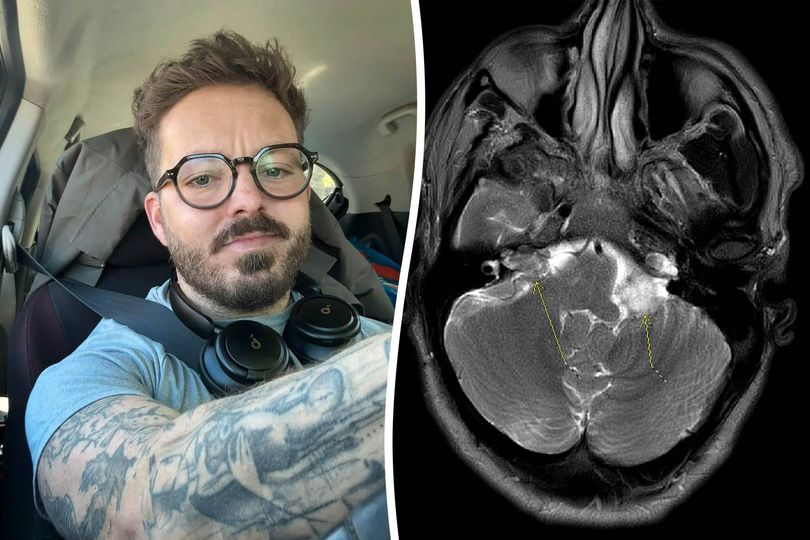 I thought 'I'm going to die' when doctor showed me brain scan