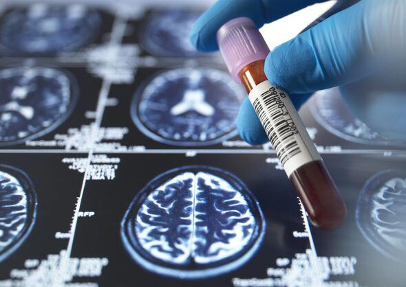 Blood pressure dementia risk warning to anyone with reading above key ...