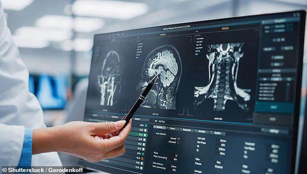 Little-known migraine trigger that causes debilitating headaches for ...