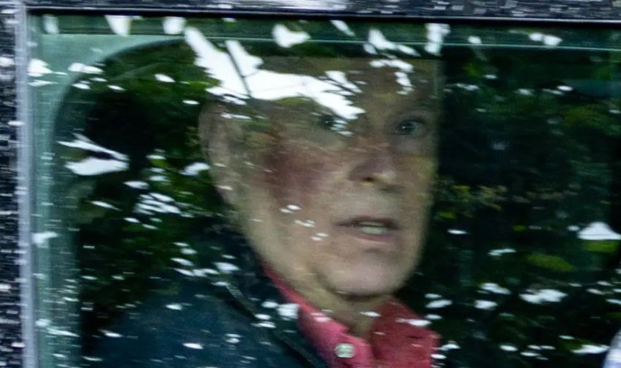 Andrew's bruised face reason revealed