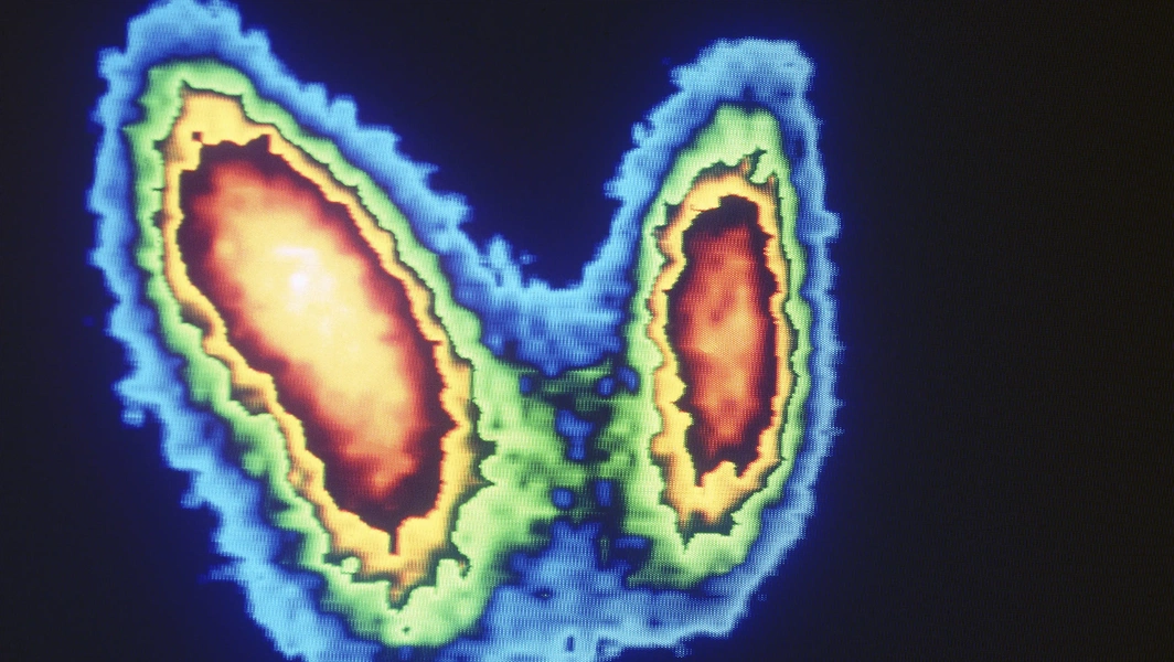 Thyroid health tips every woman should know