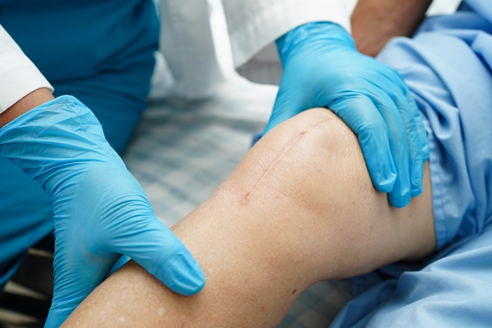 Medication could reduce the need for knee replacements in ...