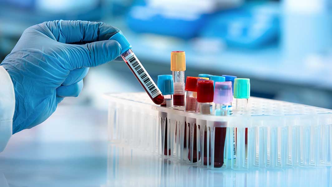 Here's why this colon cancer testing biotech is a mutual fund favorite