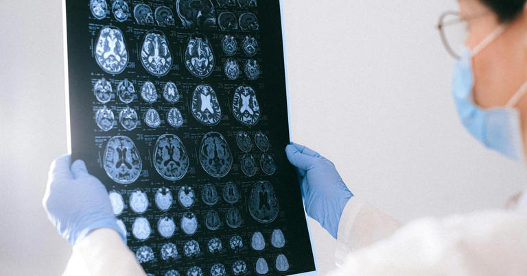 The symptoms of 'snowflake disease' - and why it 'becomes more severe ...