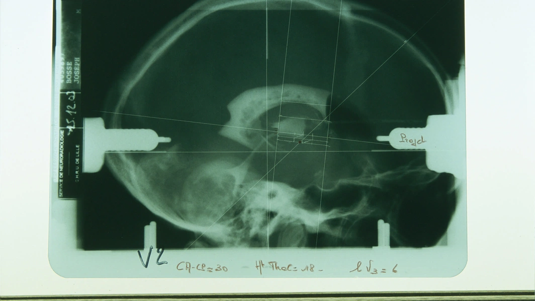 Newly found brain rhythm may be key to consciousness