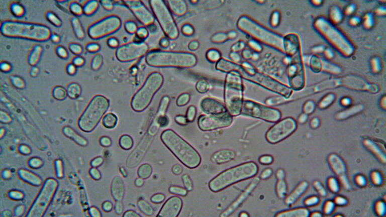 Overactivating activin signaling by injection, chimerism, or bacterial ...