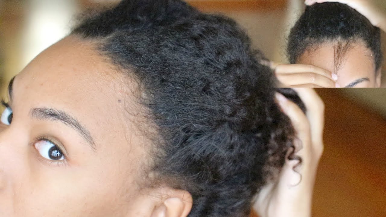 How I regrew my hairline after breakage | Easy hair growth routine