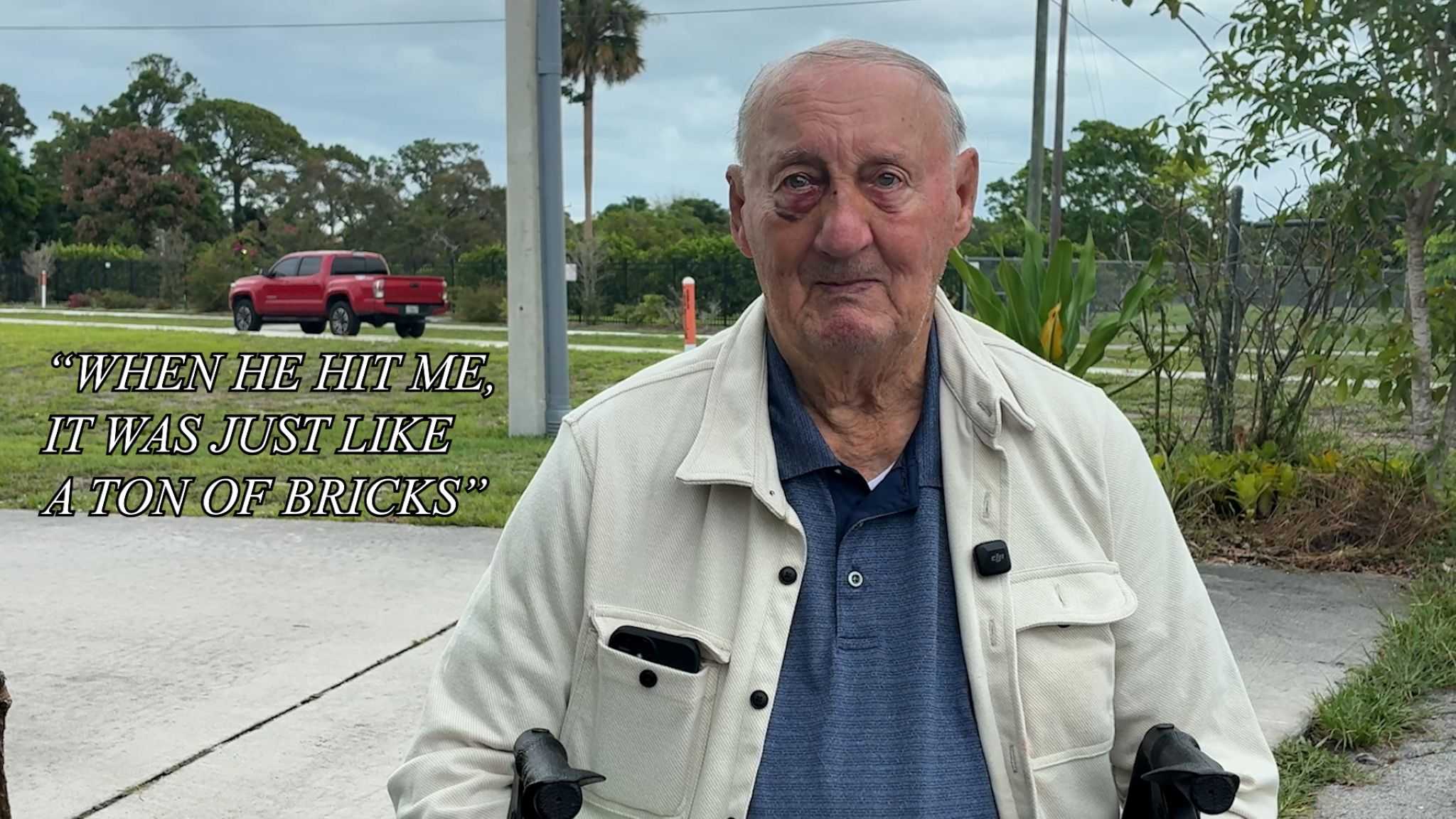 94-year-old man punched in the face while riding his scooter to church