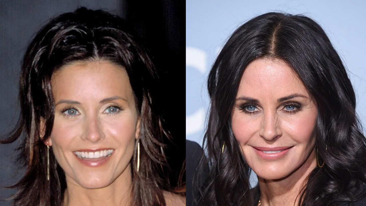Doctor reacts to celebrity plastic surgery fails