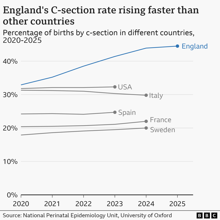 One in four births in England is now emergency caesarean, BBC analysis ...