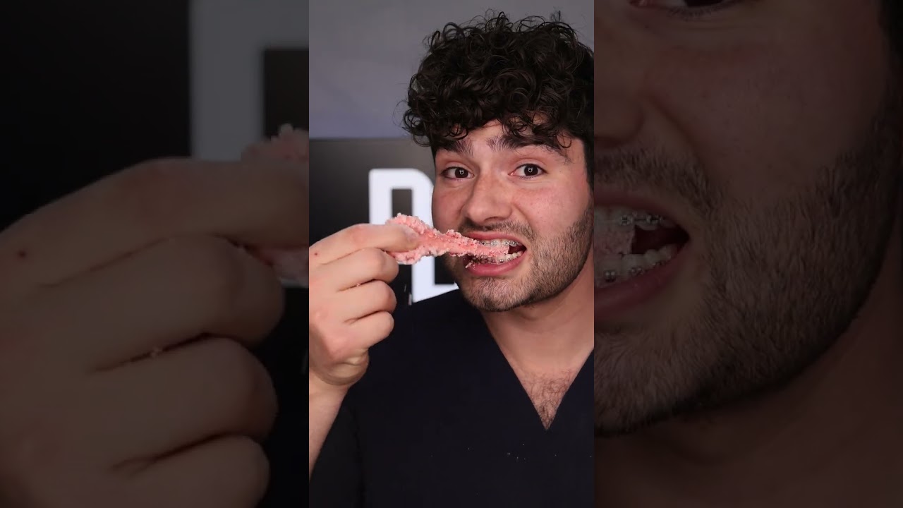 Ice cream vs braces?