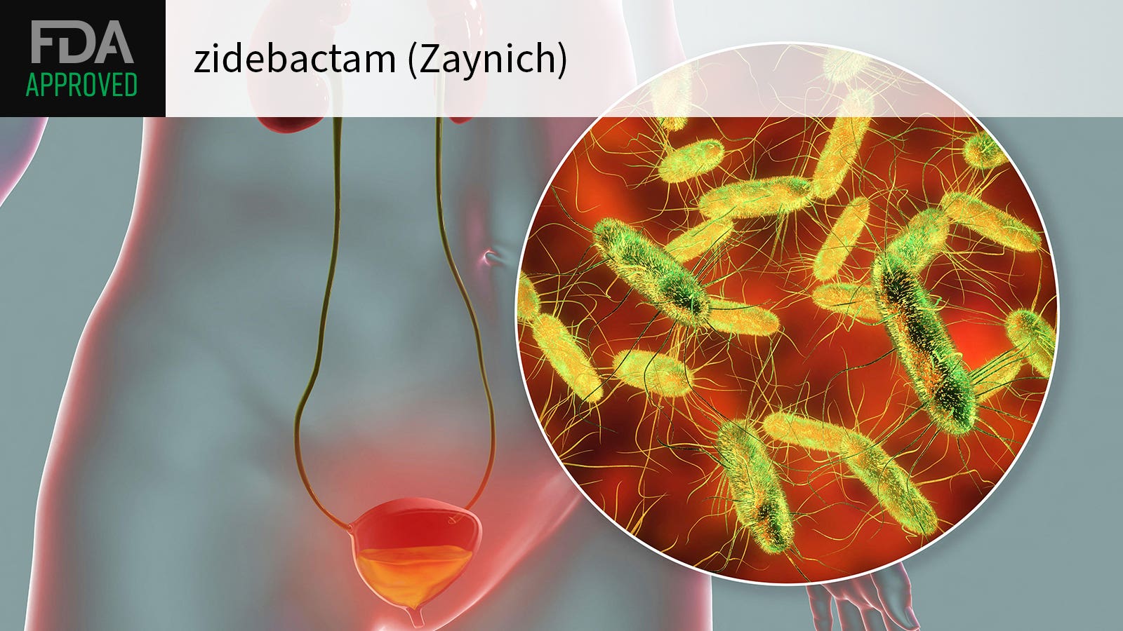 Antibiotic combo approved for multidrug-resistant UTIs