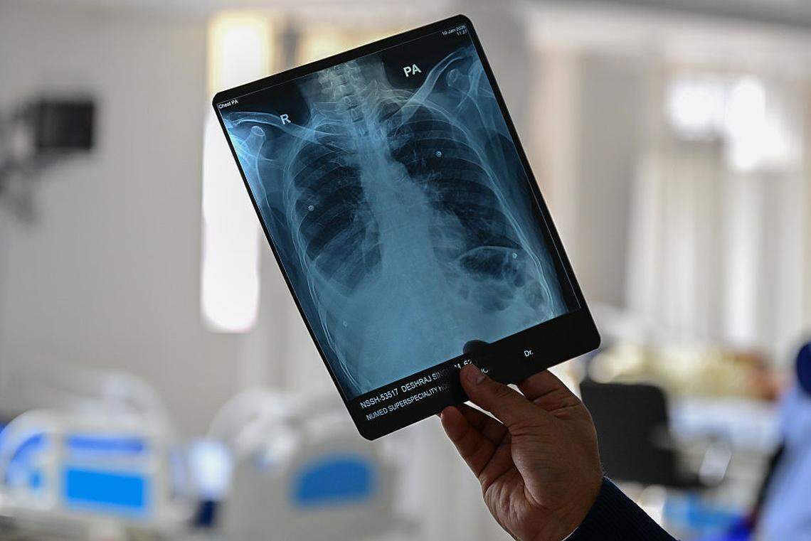 A new study found the hidden bone switch that could reverse ...