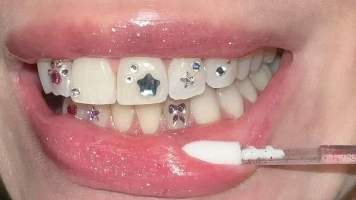 There is a new beauty trend to 'express yourself'—tooth piercing