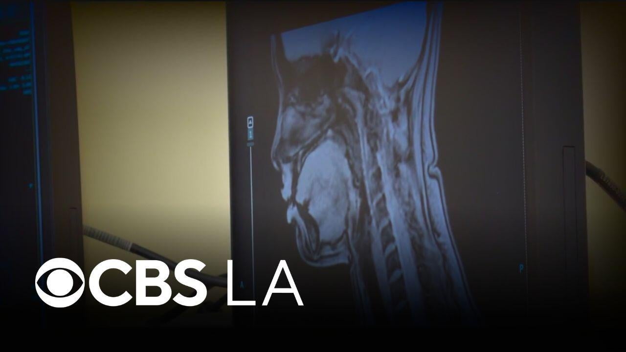 Concussion symptoms young athletes should be aware of