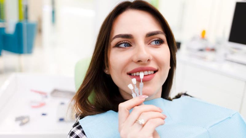 What are dental veneers? Benefits, cost and more