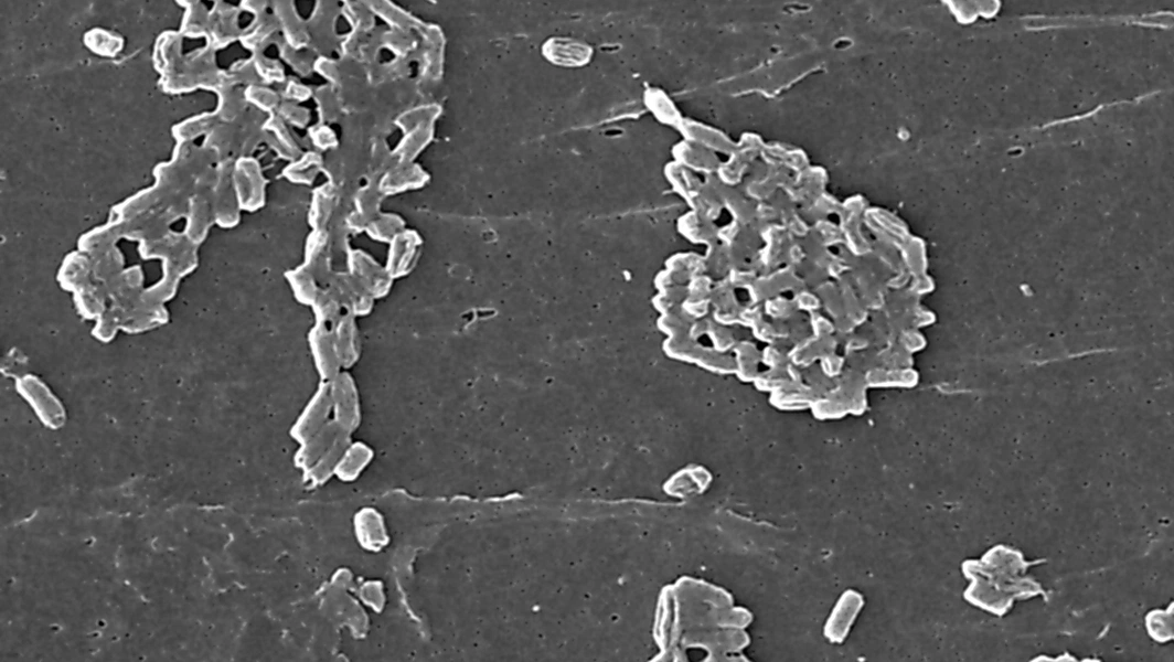 15 hidden germ hotspots in your home