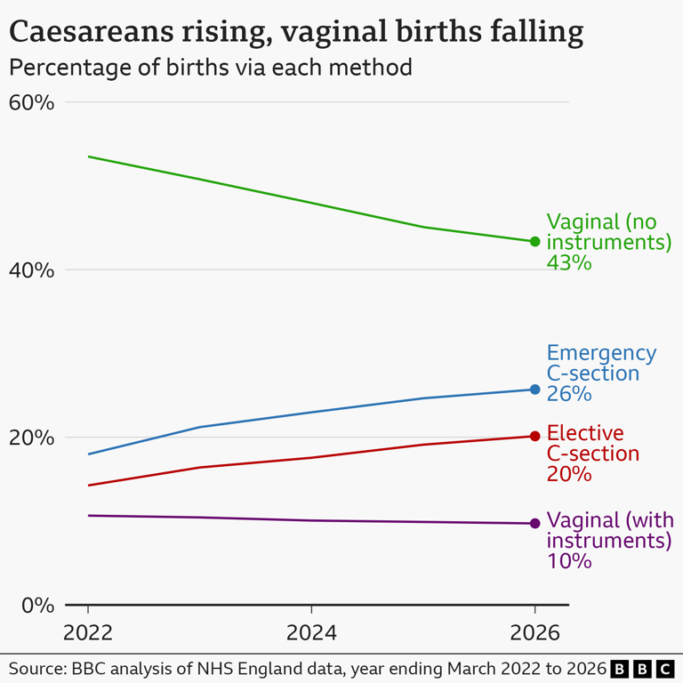 One in four births in England is now emergency caesarean, BBC analysis ...