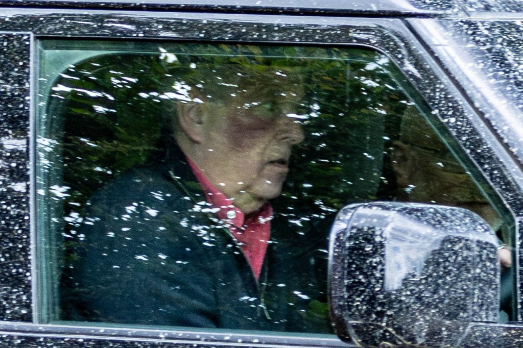 Andrew Mountbatten-Windsor spotted with huge mystery bruise on his face