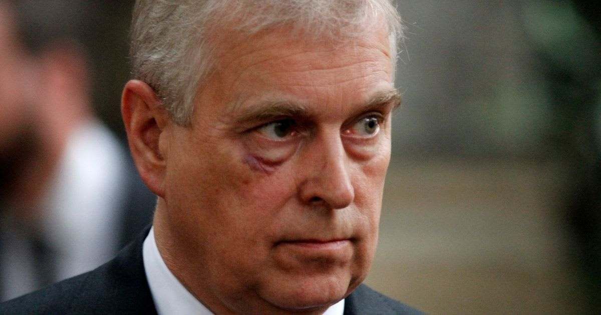 Andrew spotted with mysterious bruise just days after being confronted ...