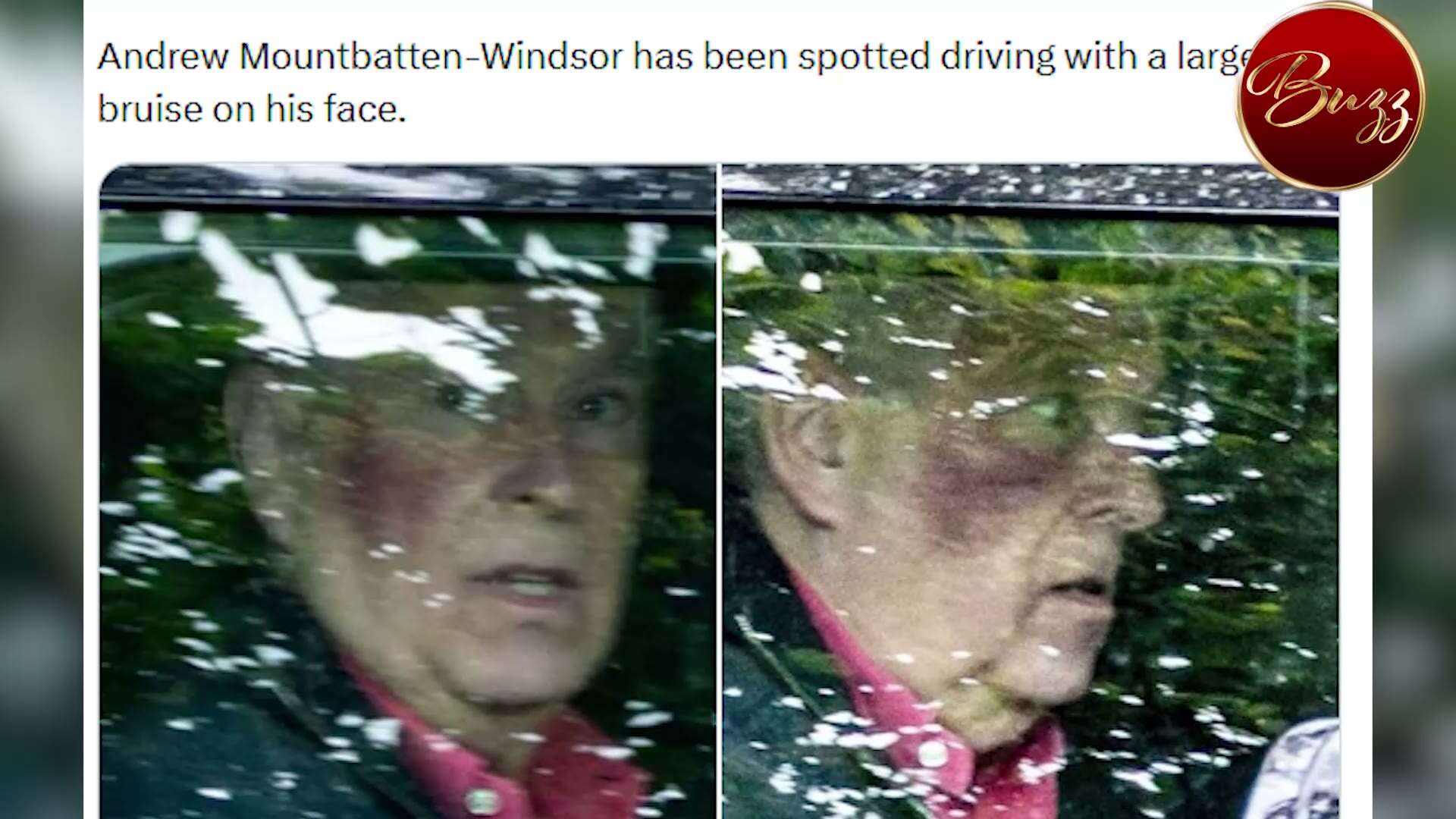 Andrew's shocking facial bruise triggers questions, palace insider ...