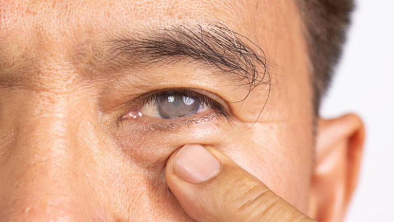 The first thing cataracts steal isn't vision: The subtle changes many ...