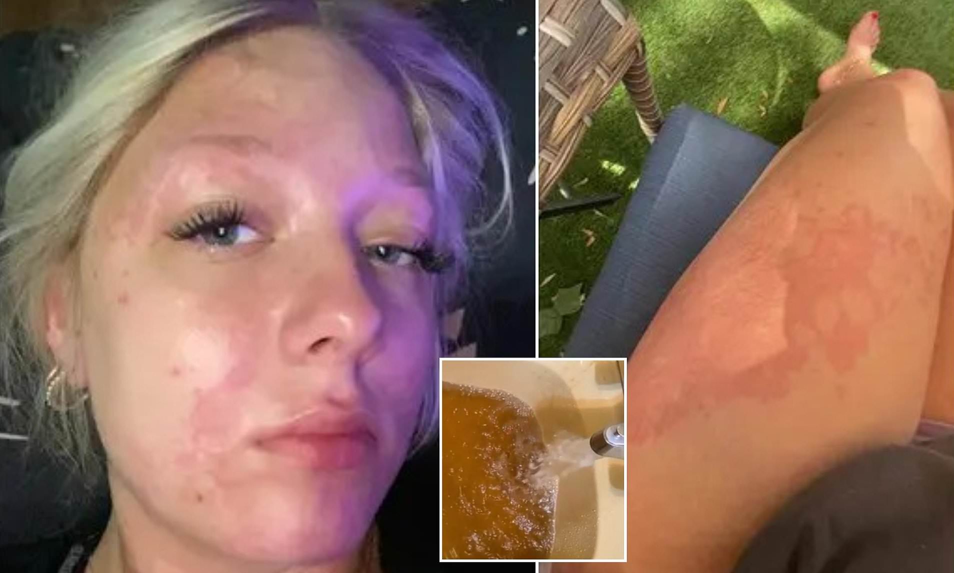 Small Texas town rocked by water crisis after teen girl is hospitalized ...