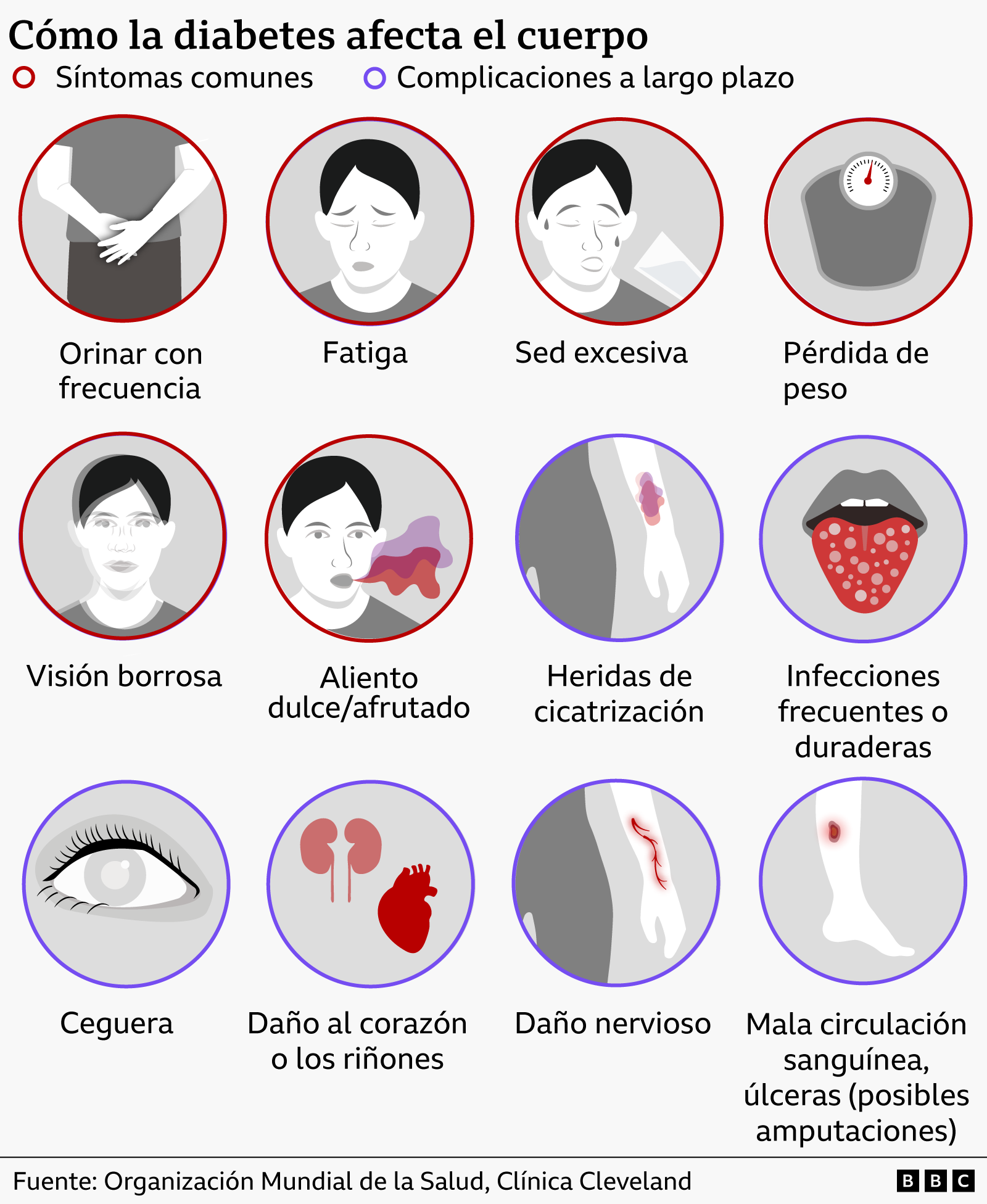 Diabetes tipo 5, la nueva y desconocida categoría de la enfermedad que ...