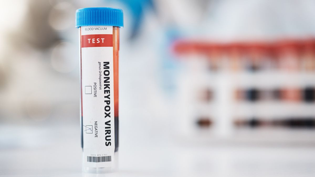 DOJ charged 2 NIH scientists with smuggling deactivated monkeypox virus ...
