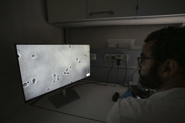Yeast found in iceman’s 5,000-year-old gut has been used to make sourdough