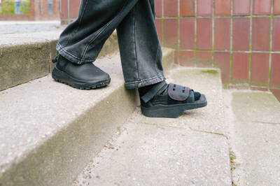 Charcot foot: The hidden diabetic complication that many patients overlook
