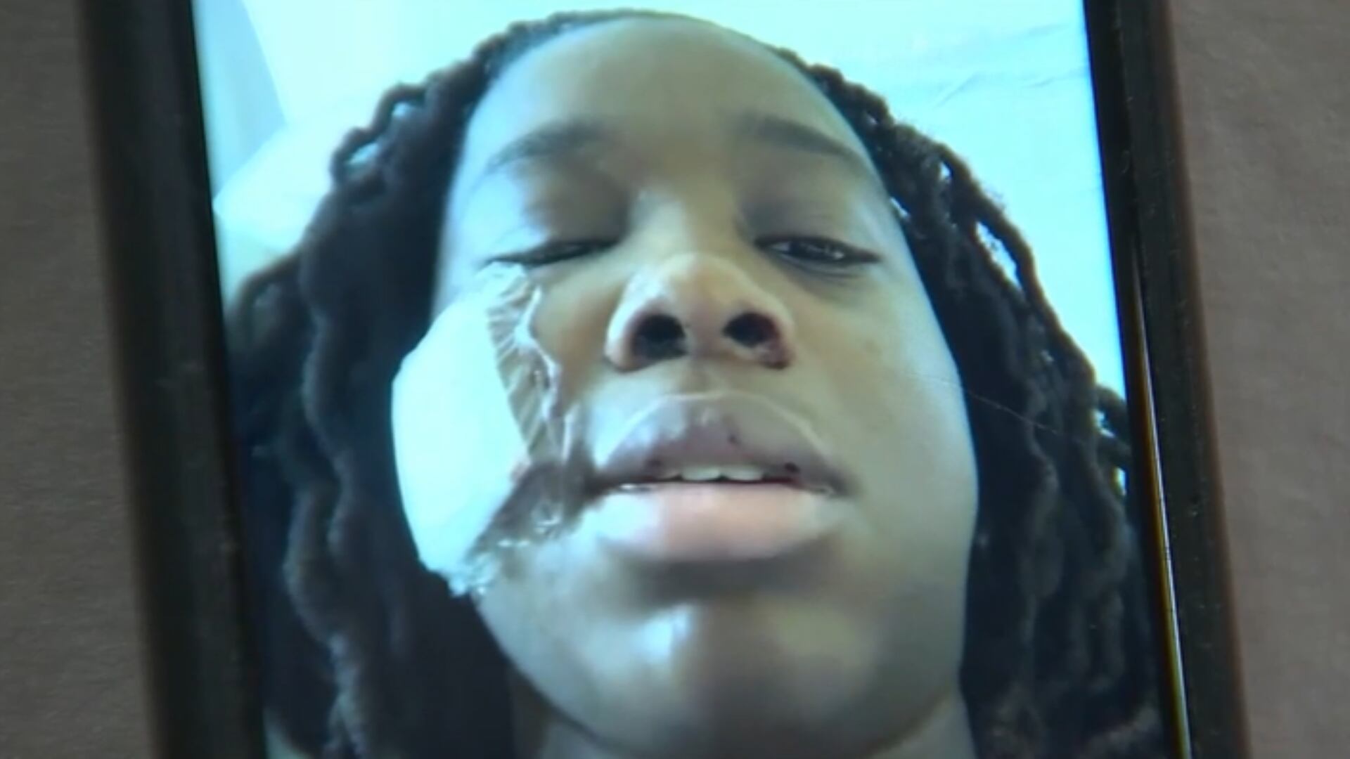Metro Atlanta woman recovering after being shot in the face during ...