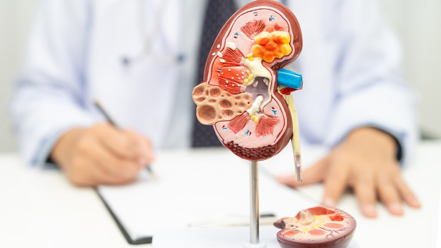 Novartis reports positive results from Phase III ALIGN trial for IgAN
