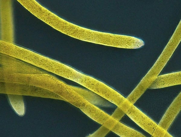 Trouble bubbling at Peace River: Blue-green algae sparks health alert ...